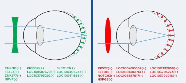 Shaping the Eye for Perfect Vision | Columbia University Irving Medical ...