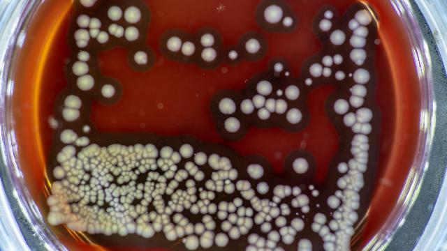 In Cystic Fibrosis, Lungs Feed Deadly Bacteria | Columbia University ...