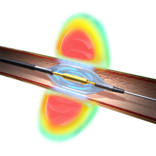 Ultrasound Device May Offer New Treatment Option for Hypertension ...