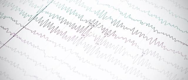 Sleep Patterns May Reveal Comatose Patients with Hidden Consciousness ... Sleep Patterns May Reveal Comatose Patients with Hidden Consciousness ...