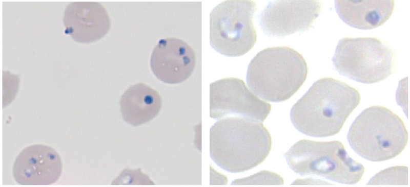 Malaria Parasites Can Hide From Our Drugs. Now We Know Why. | Columbia ...