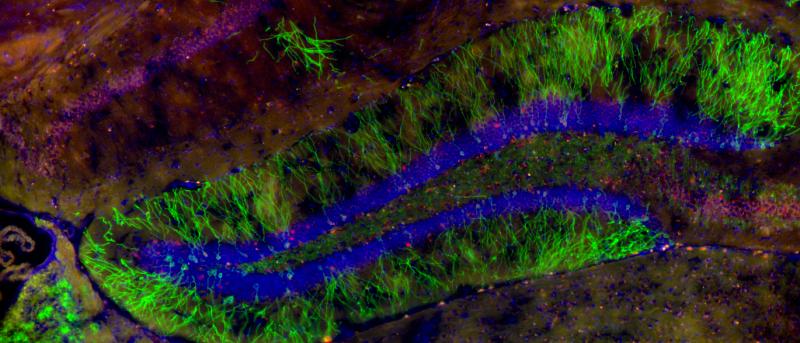 Baby Neurons in Adult Brains Are Needed to Maintain Memory | Columbia ...
