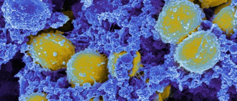 Staph’s Achilles' Heel May Be Its “Stomach” | Columbia University ...
